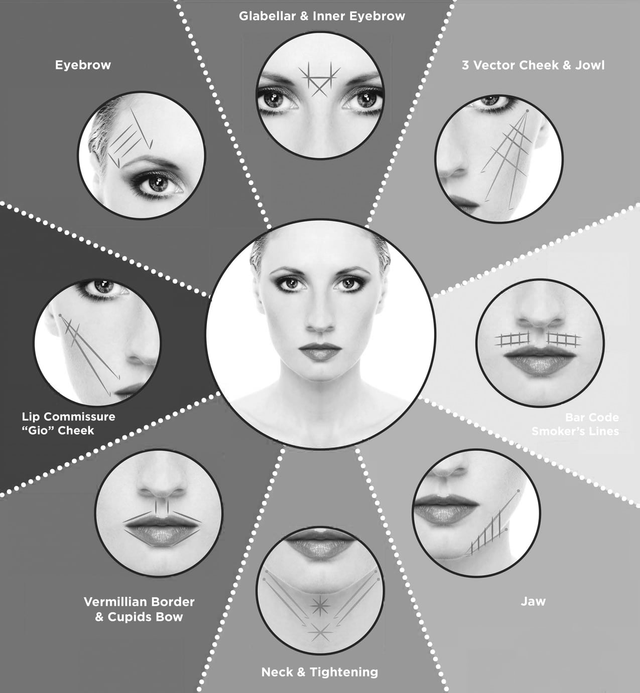 PDO Thread Lift - Greenwich Dermatology